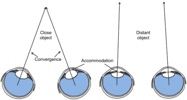 Comprehensive Eye and Vision Exam - Chan May May