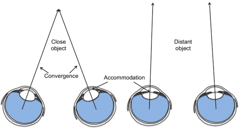 Comprehensive Eye and Vision Exam - Chan May May